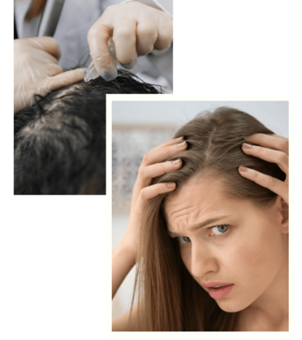 Alma TED Treatment – HCI Hair solutions
